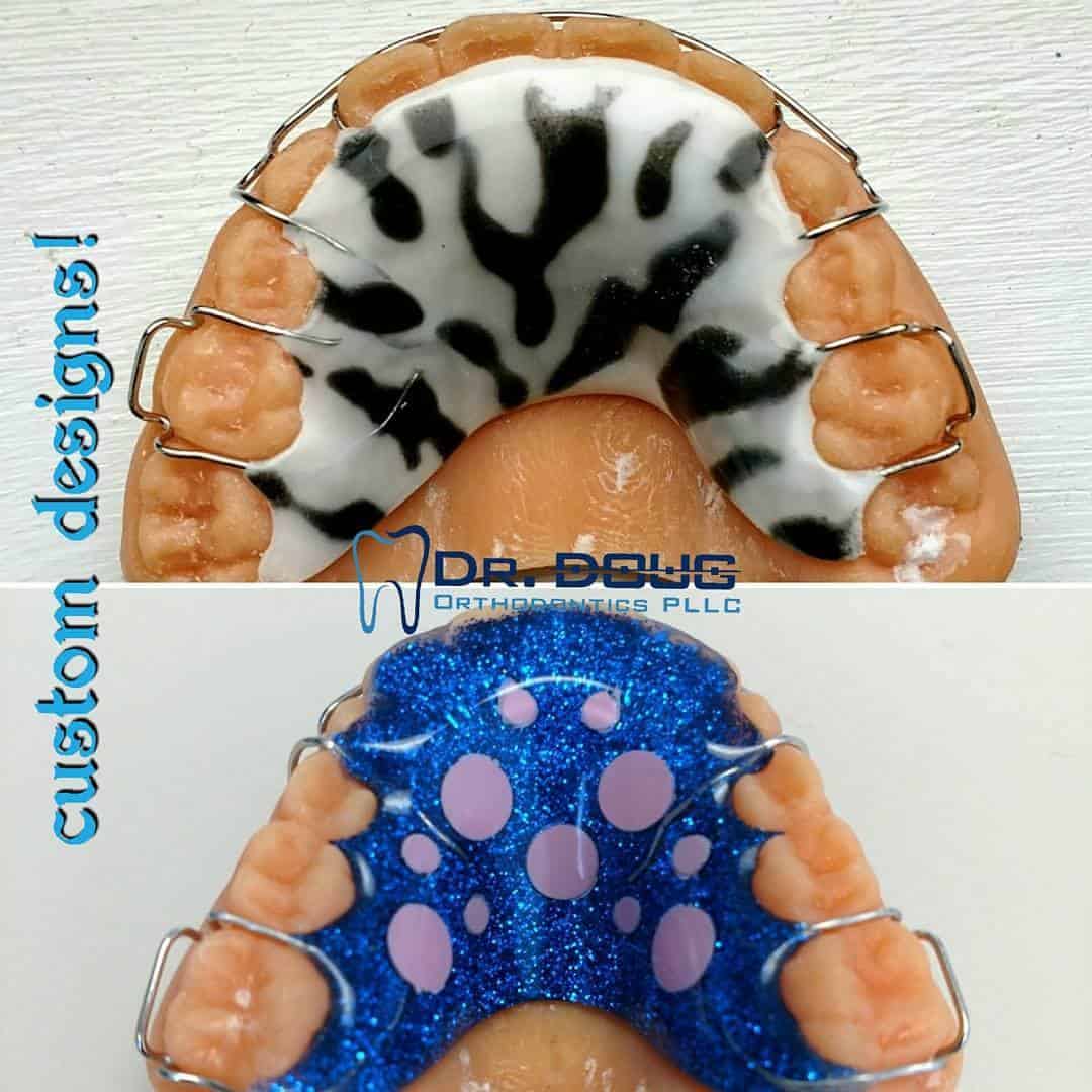 Orthodontic Retainers Rockville Centre NY | Dr. Doug Orthodontics